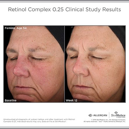 Before & After – Retinol Complex 0.25 – Allergan Brandbox